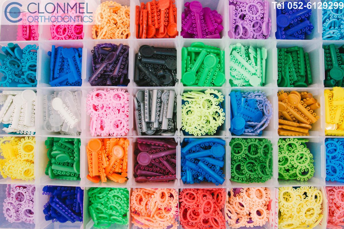What are Coloured Braces? - Clonmel Orthodontics